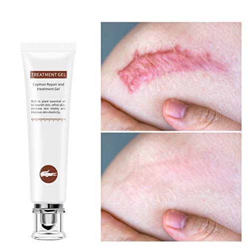 Narbencreme kaufen – Ratgeber für deinen Vergleich & Test!