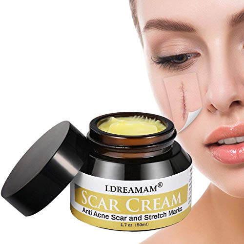 Narbencreme kaufen – Ratgeber für deinen Vergleich & Test!